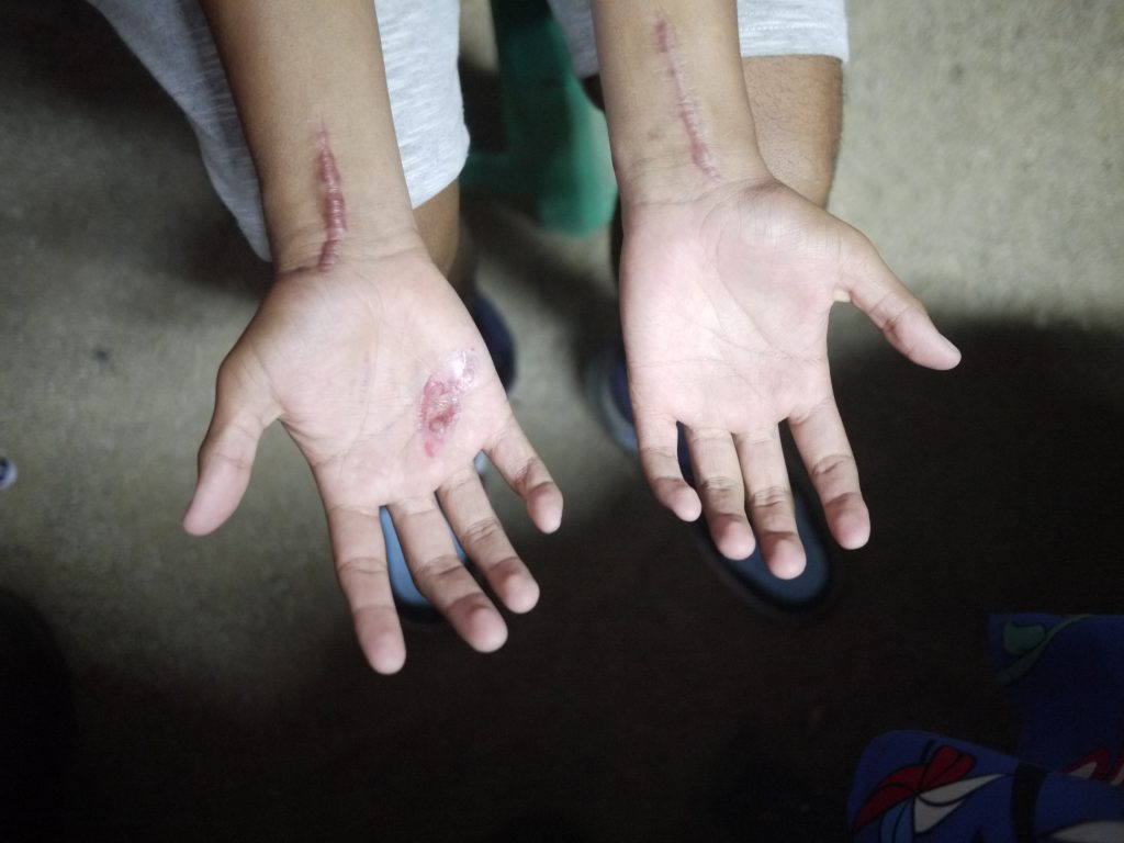 Anthony, el joven lanzado al río por Carabineros: «Nuestra lucha ha ...