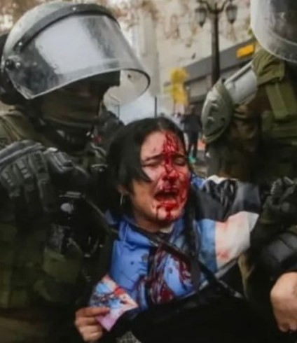 Voluntaria de la defensoría jurídica de la Universidad agredida ...